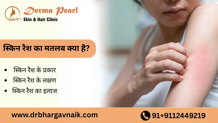 स्किन रैश का मतलब क्या है? कारण, प्रकार और उपचार (Skin Rash Meaning in ...